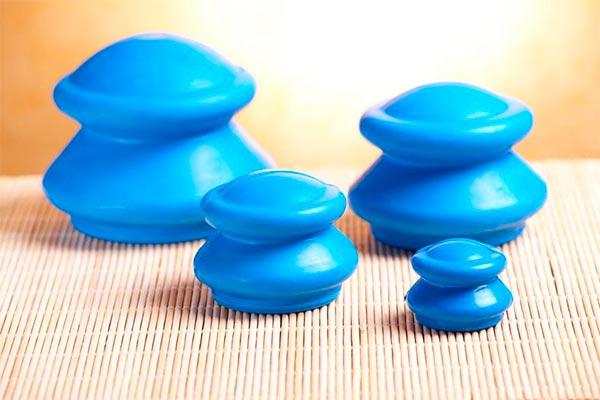 Cupping Therapy | Active Lifestyle Clinic